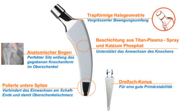 Künstlicher Gelenkersatz - Orthopädie | Ordensklinikum Linz
